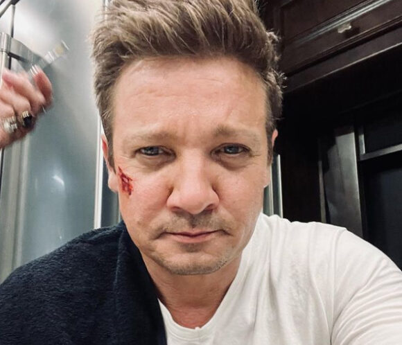 American actor Jeremy Renner, who had an accident, is in a critical but ...
